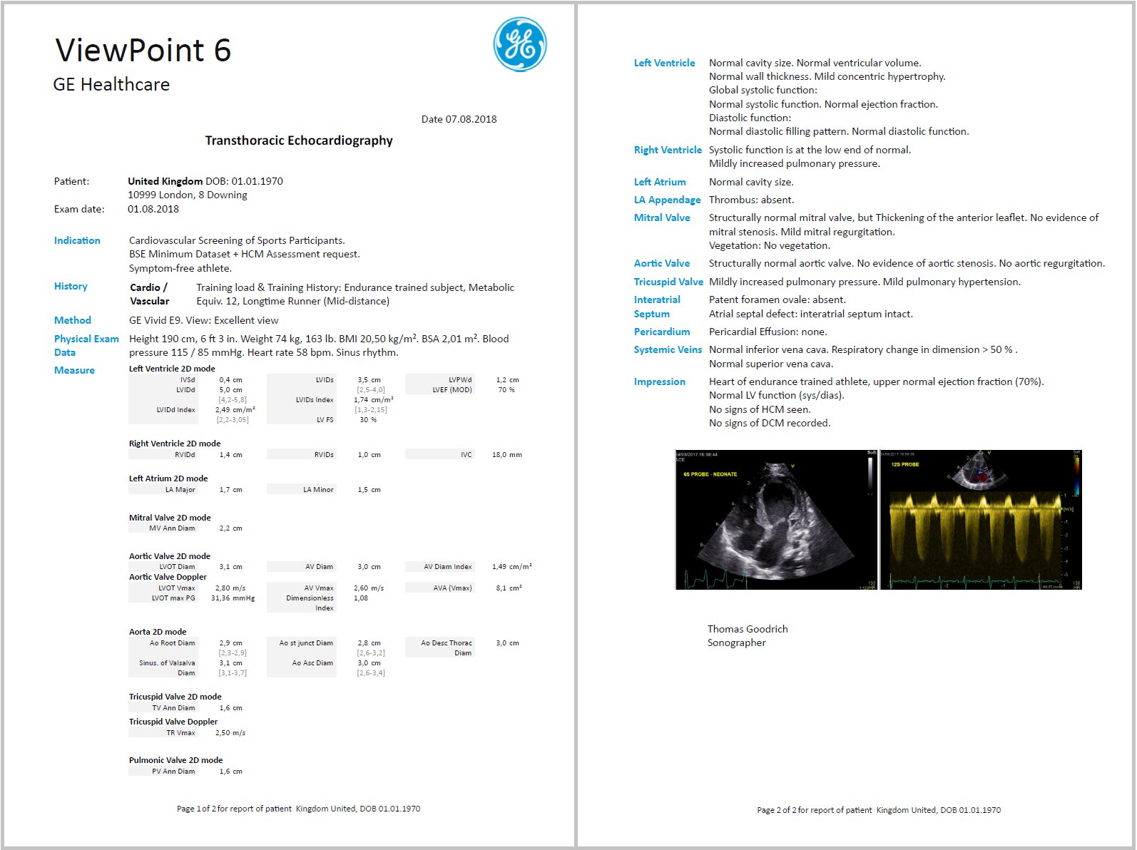 ViewPoint 6 and EchoPAC Suite for Cardiology - Ultrasound IT ...