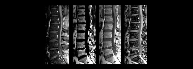 Magnetic Resonance Imaging (MRI) | GE Healthcare UK | GE Healthcare