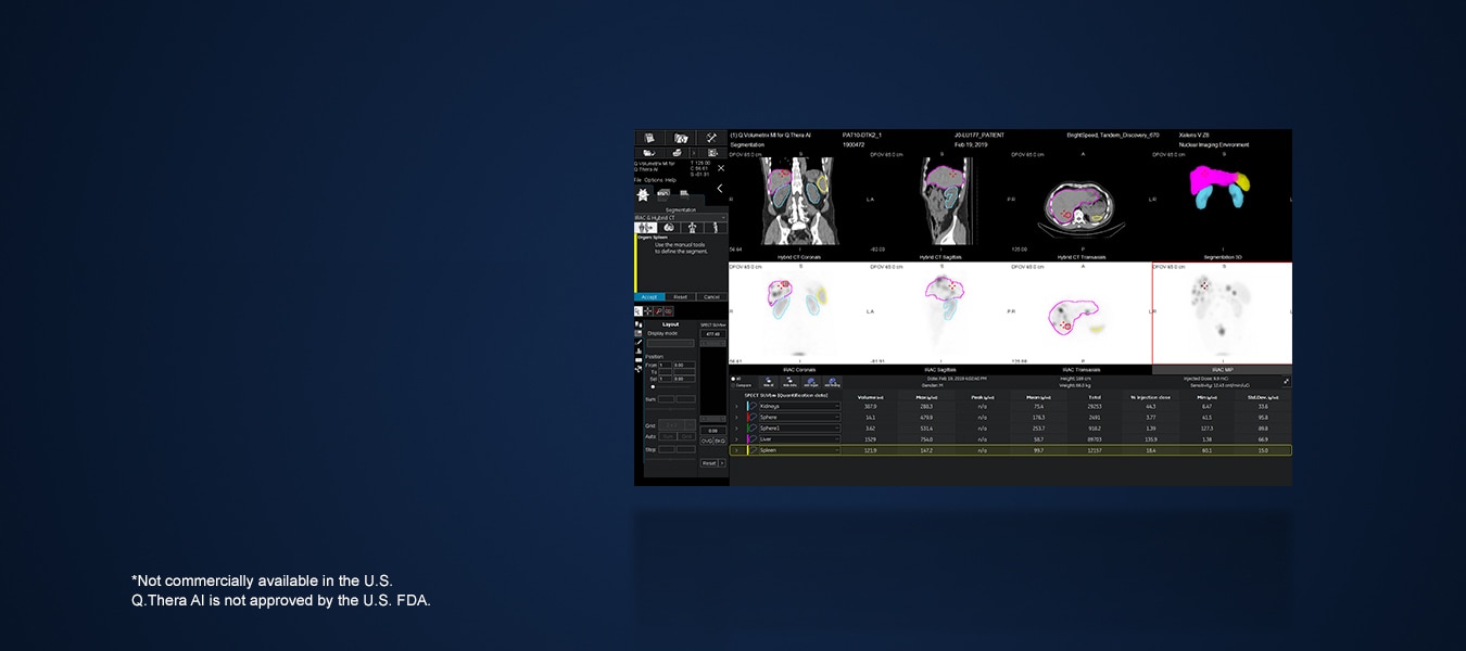 Xeleris V | GE Healthcare (United Kingdom)