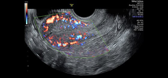 2D, 3D and 4D Ultrasound | Voluson S8 | Voluson Signature Series | GE ...