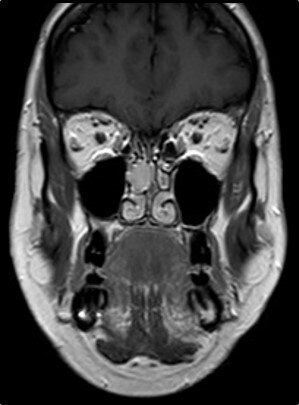 Clariscan | GE Healthcare