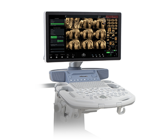 2D, 3D and 4D Ultrasound | Voluson S8 | Voluson Signature Series | GE ...
