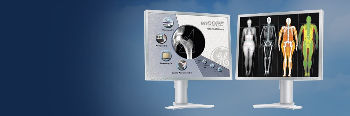enCORE v18 Software Plateform | GE Healthcare (United Kingdom)