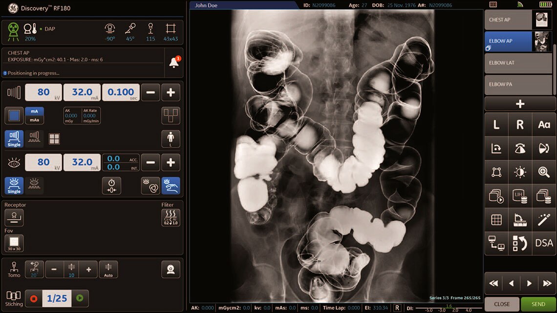 Discovery RF180 Radiography and Fluoroscopy System | GE Healthcare ...