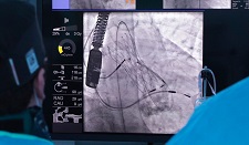 Meet the first european allia igs 7 dedicated to cardiovascular ...