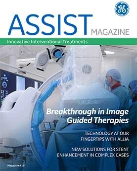 Interventional Image Guided Systems | GE Healthcare (United Kingdom)