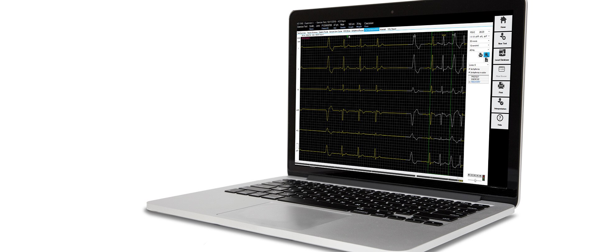 CardioSoft-v7-sp7 | GE HealthCare (United Kingdom)