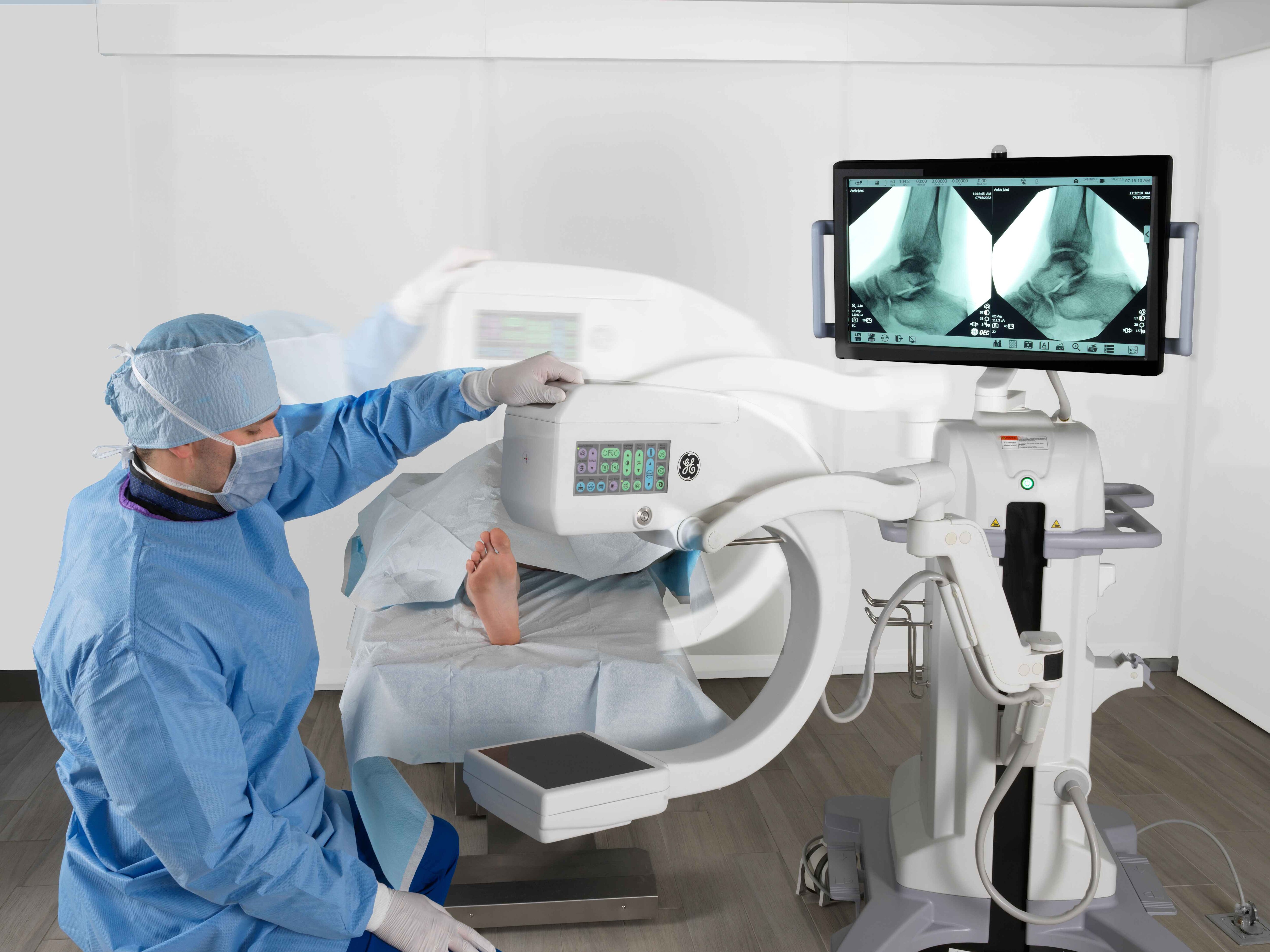 OEC MiniView MAX | GE HealthCare (United Kingdom)