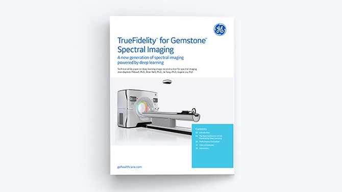 Revolution™ Apex Platform | GE Healthcare (United Kingdom)