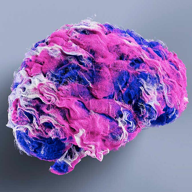 MR image reconstruction with AIR™ Recon DL | GE HealthCare (United Kingdom)