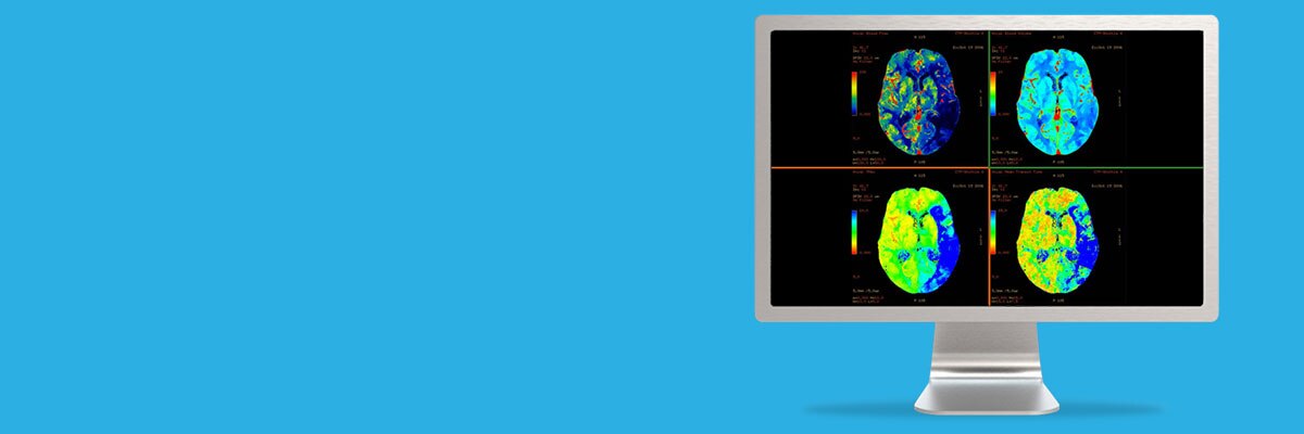 CT Perfusion 4D Neuro | GE Healthcare (United Kingdom)