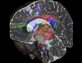 BRAIN View | GE HealthCare (United Kingdom)