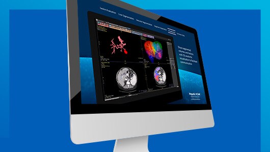 Hepatic VCAR | GE Healthcare (United Kingdom)