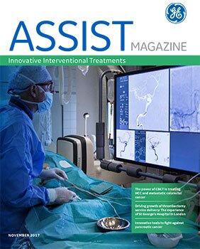 Interventional Image Guided Systems | GE Healthcare (United Kingdom)