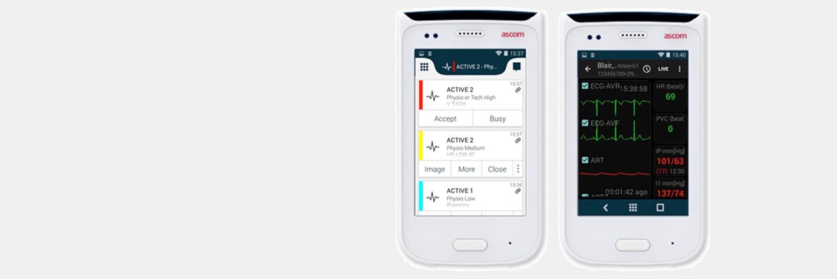 利用手机摄像头实现心率检测：技术与实践-CSDN博客