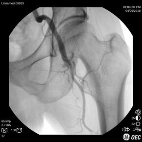 OEC One CFD | GE HealthCare (United Kingdom)