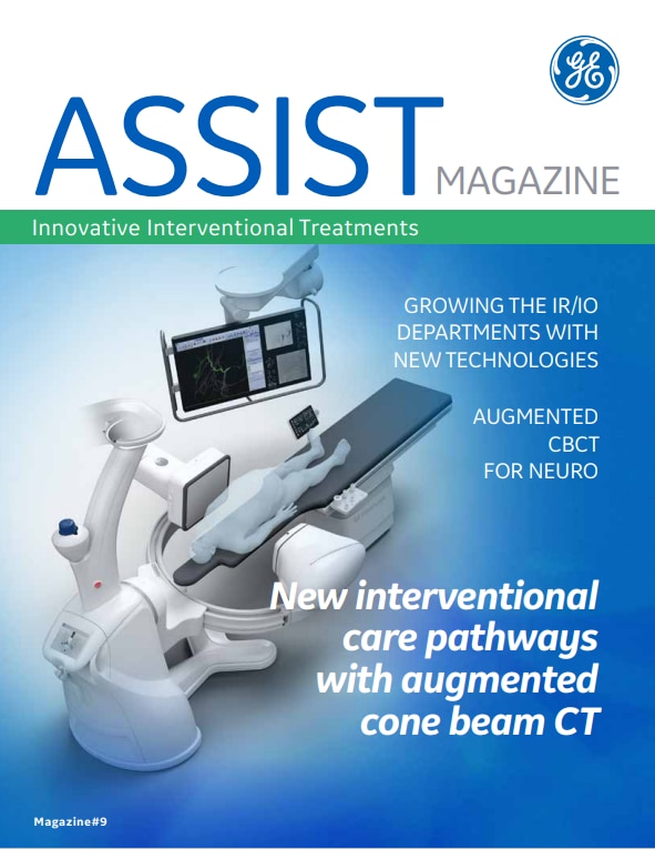 Interventional Image Guided Systems | GE Healthcare (United Kingdom)