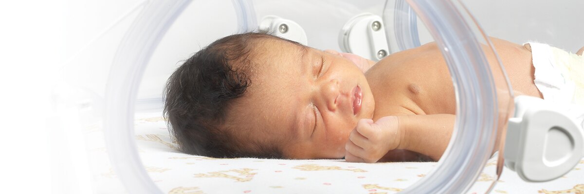 Giraffe Shuttle | Intra-hospital transportation solution | GE ...