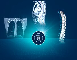 Bone Vcar | GE HealthCare (United Kingdom)