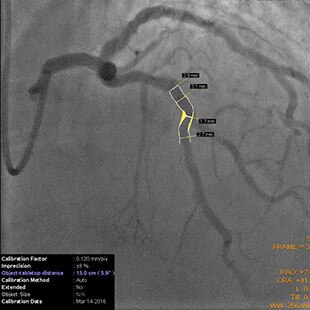 PCI ASSIST | GE Healthcare (United Kingdom)