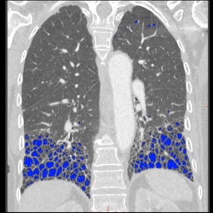 Image Gallery - Revolution CT - Computed Tomography - Products | GE ...