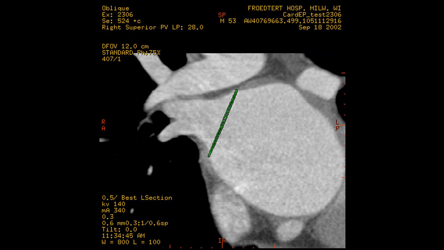 CardEP | GE Healthcare (United Kingdom)