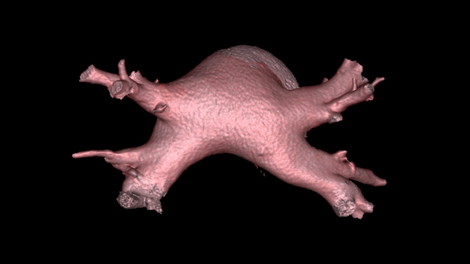 CardEP | GE Healthcare (United Kingdom)