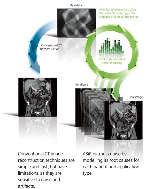 ASiR | GE Healthcare