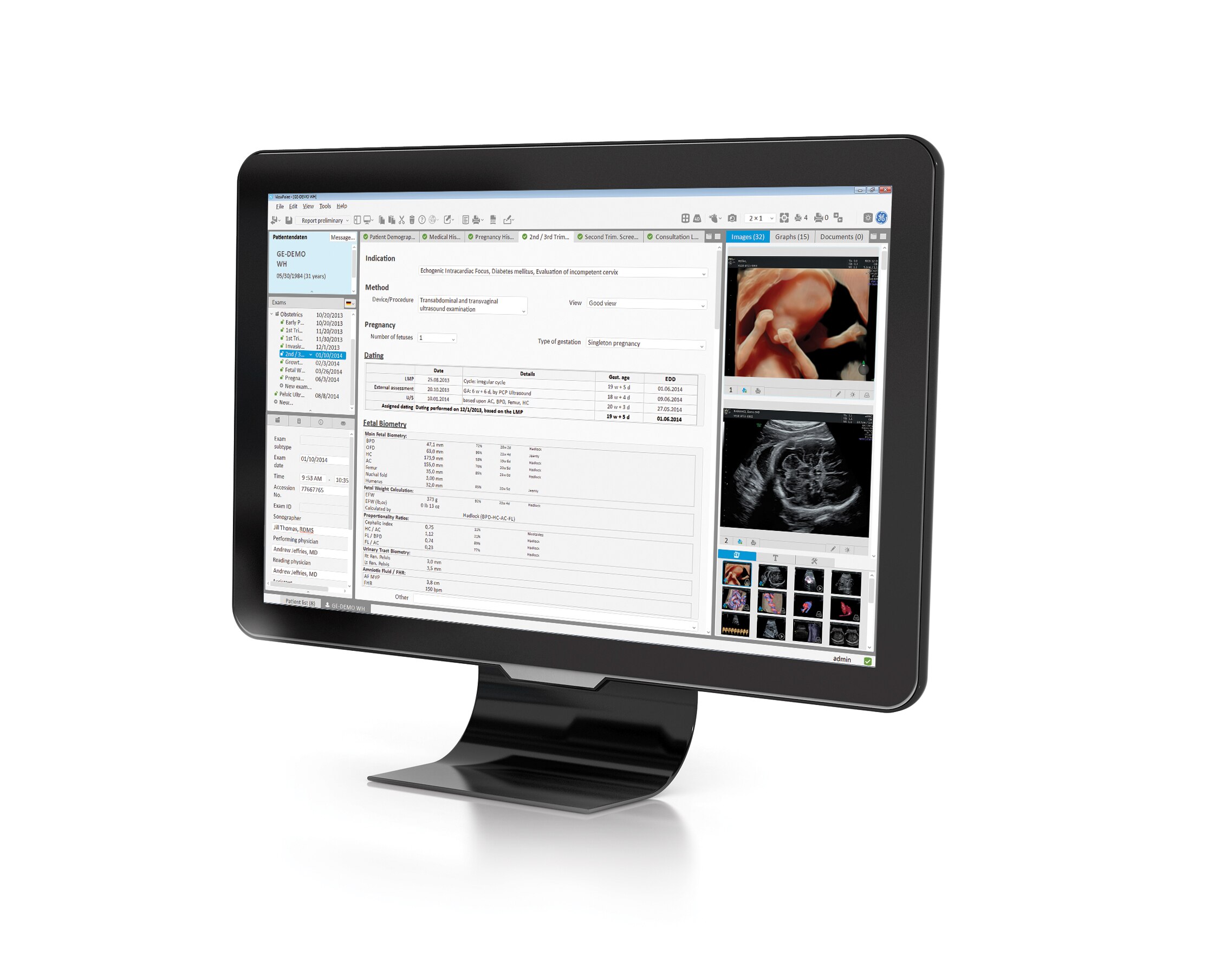 ViewPoint 6 for Womens Health - Ultrasound IT - Ultrasound - Categories ...