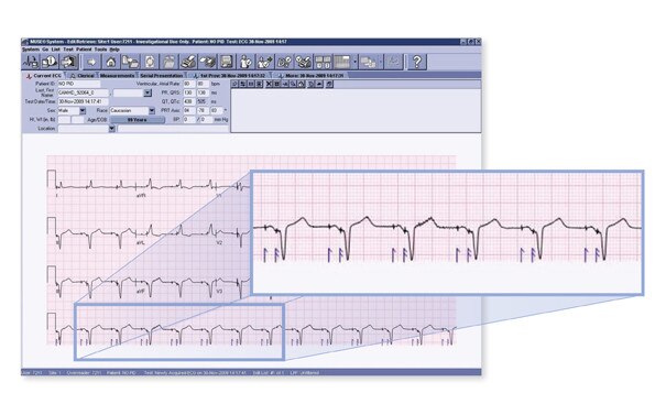 MUSE Cardiology Information System | GE Healthcare