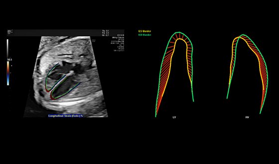 Voluson E10 | GE Healthcare